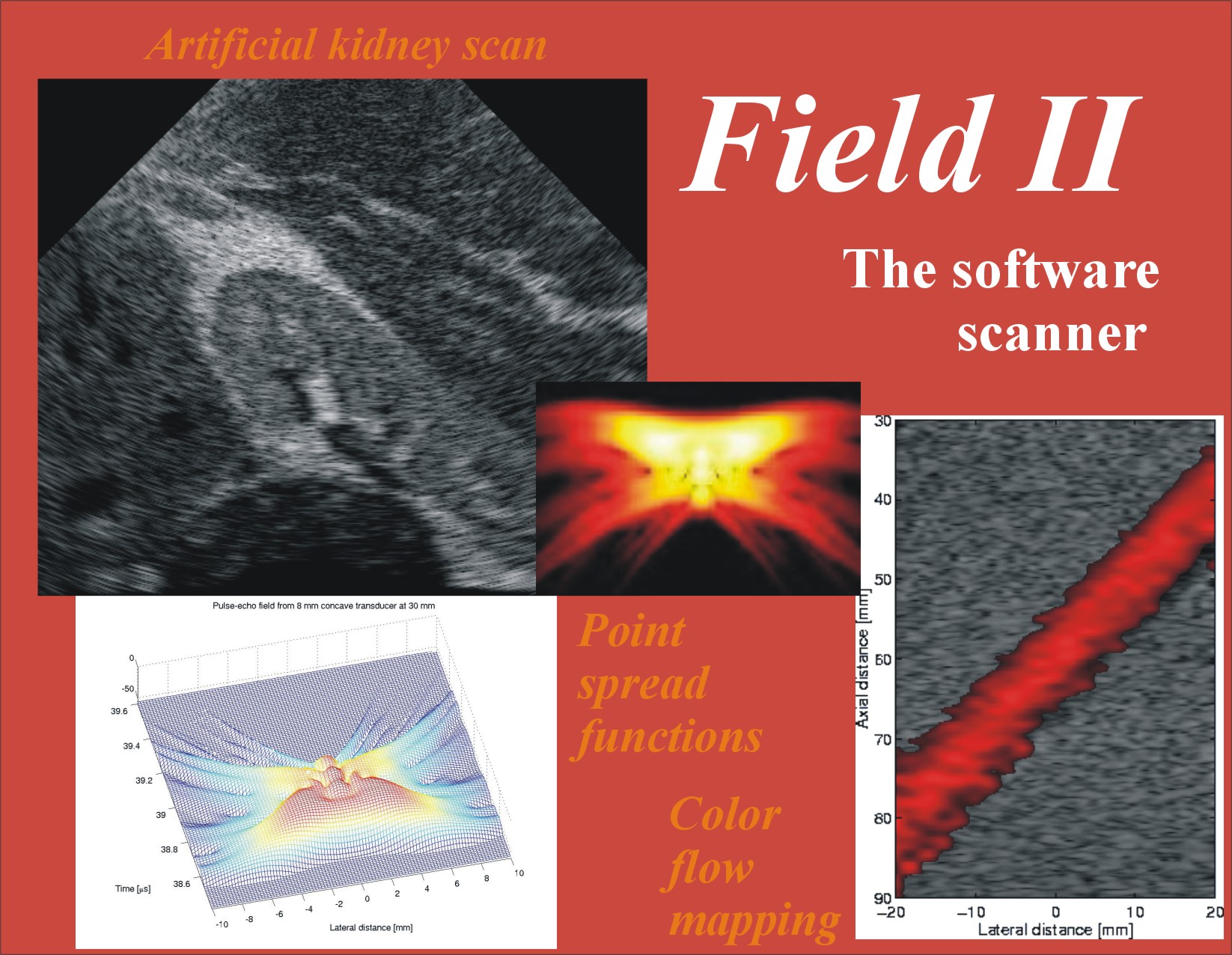 Field II Ultrasound Simulation Program